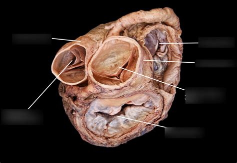 Cadaver Heart Diagram Diagram Quizlet