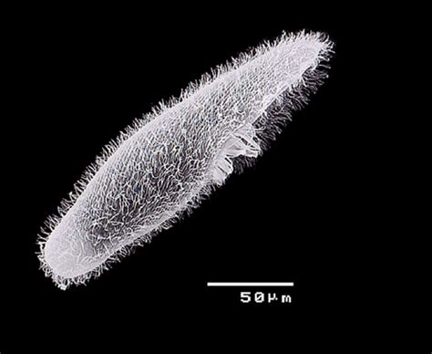 Blepharisma Japonicum Sem Download Scientific Diagram