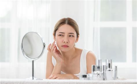 Mụn Li Ti Nguyên Nhân Do Đâu Cách Trị Mụn Li Ti Kiehls