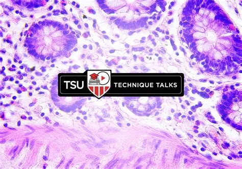 Technique Talk Developing And Optimizing Immunohistochemistry Protocols The Scientist