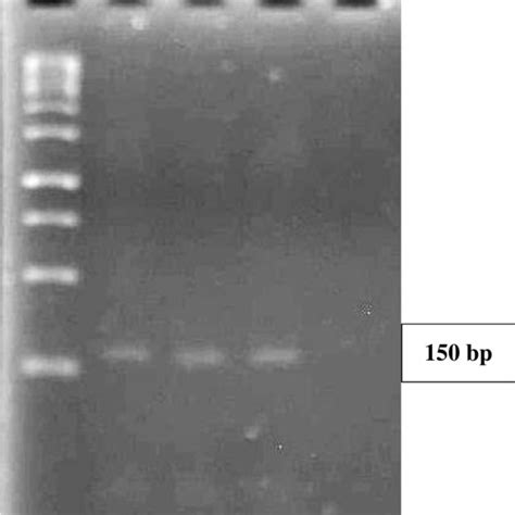Pcr Of Staphylococcus Aureus Specific Nuc Gene Size 279 Bp Here Download Scientific