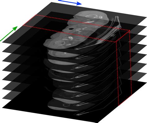 fully automated deep learning slice based muscle estimation from ct