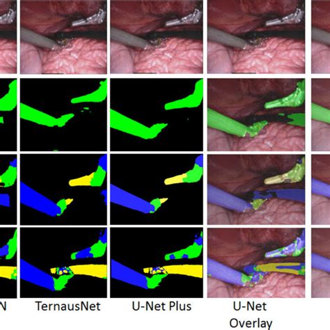 Qualitative Comparison Of Binary Segmentation Instrument Part And