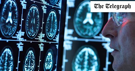 The Smart Box That Could Spot First Signs Of Brain Decline In Your Home