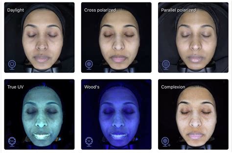 What Would Your Skin Analysis Reveal Skin Enhance And Wellness