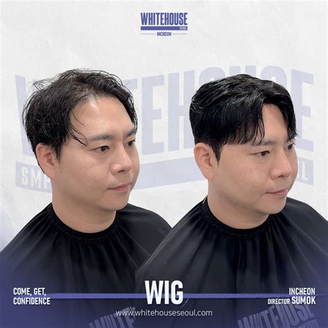 부분가발 화이트하우스서울