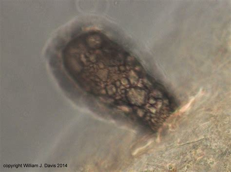 Wandering Naturalist Protist Love 1 Difflugia