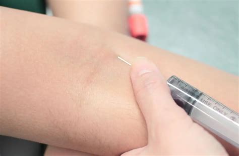 Tb Test Everything You Need To Know Techdailyvisit Com