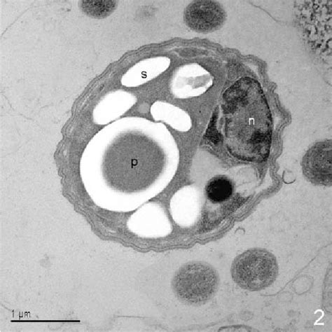 Figure 2 From The Pyrenoid Ultrastructure In Oocystis Lacustris