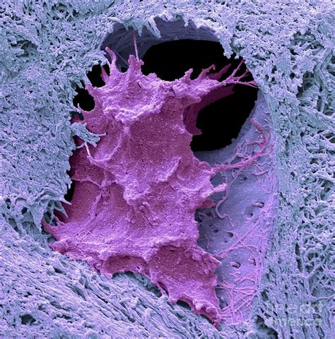 Osteocyte Bone Cell Photograph By Steve Gschmeissner Science Photo
