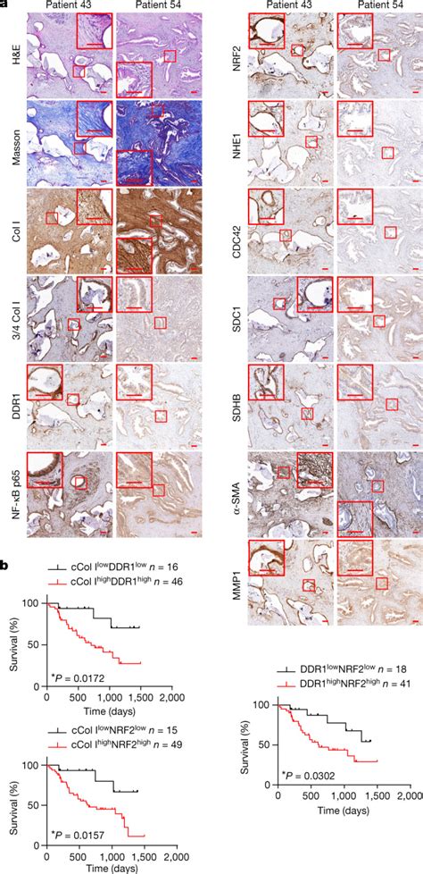 Collagenolysis Dependent Ddr1 Signalling Dictates Pancreatic Cancer