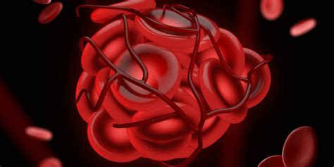 Preventing And Recognizing Pediatric Emboli Rt