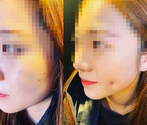 우엉재피어싱 ️순천피어싱 ️광양피어싱 ️여수피어싱 피어싱으로 만드는 보조개는 파인 정도를 조절할수가 있어서 원하시는 깊이의 보조개를 만들수있어오 그리고 생각보다 안