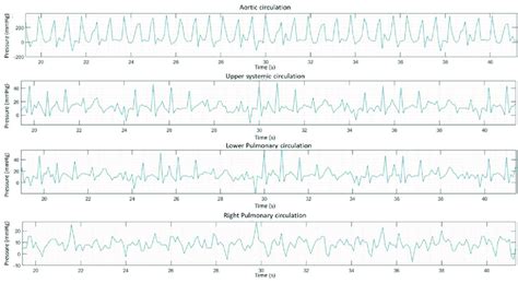 Unfiltered Pressure Waveform For 3 Mm Ijs With A Reduced Pvr Of 30 Download Scientific Diagram