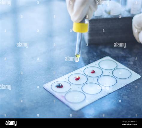 Groupe Sanguin Abo Banque De Photographies Et Dimages à Haute Résolution Alamy