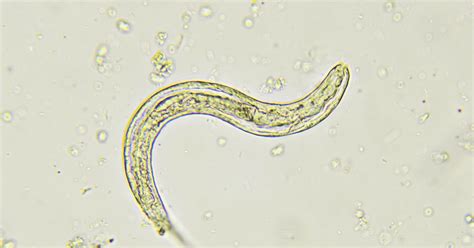 All About Pinworms Symptoms Treatments And Prevention Dr Green Mom