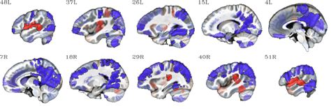 Four Effects Overall ISC SRS Sex And Age Derived From BML Are Download Scientific Diagram