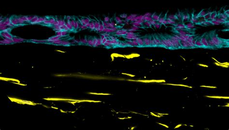 Emulate Chip A1 Accessible Chip