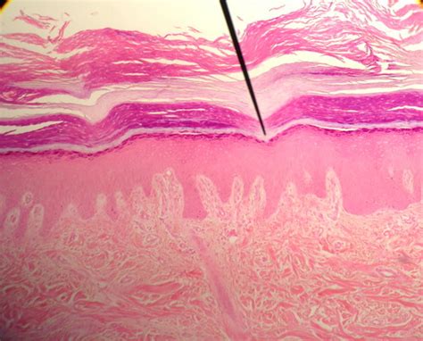 Unit 6 Integumentary Flashcards Quizlet