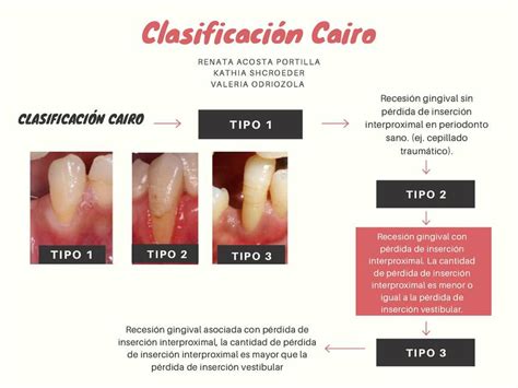 Clasificación De Cairo Y Miller Renata Acosta Portilla Udocz