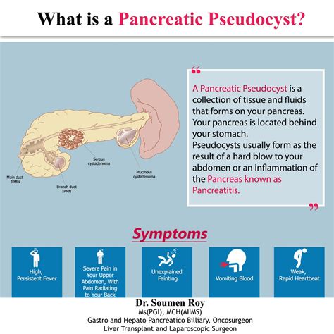What Is A Pancreatic Pseudocyst A Dr Soumen Chd Ray Facebook