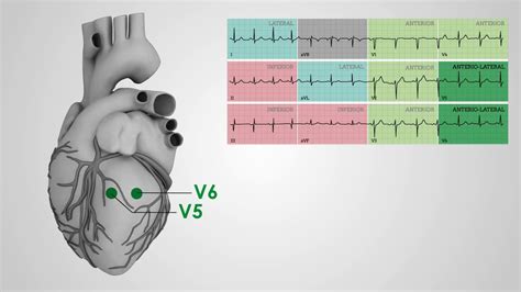 Ecg Electrode View At Willie Alexander Blog