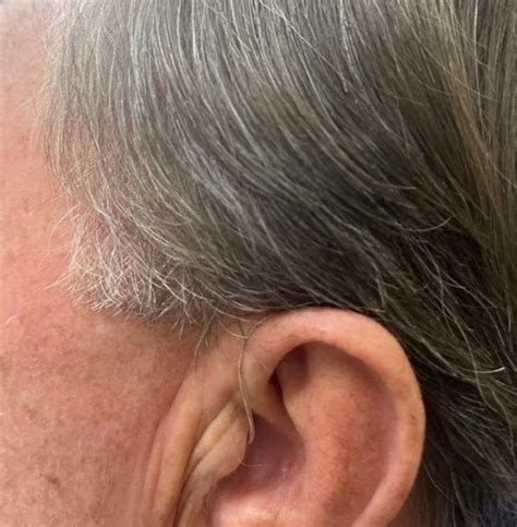 ReSound Hearing Aids Reviews Prices Models