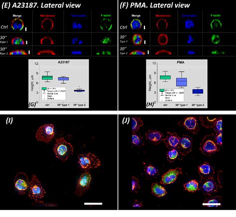 Figure 4 From Stages Of Netosis Development Upon Stimulation Of Neutrophils With Activators Of
