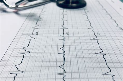 Atrial Fibrillation Guide Symptoms Causes Treatment Fourth