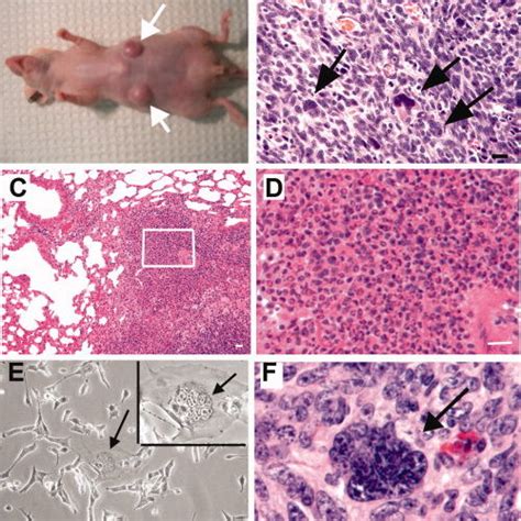 These Images Illustrate Tumor Formation By A Single Multinucleated Cell Download Scientific