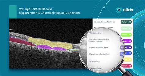 Oct Examination Vs Fundus Photography What To Choose