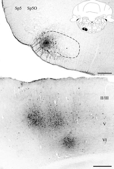 Photomicrographs Of Retrograde And Anterograde Tracer Injection Sites Download Scientific