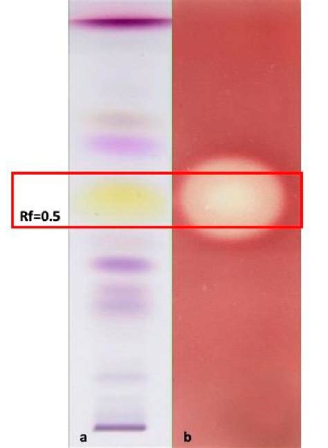 Hp Tlc Bioautographic Assay Showing The Antimicrobial Activity Of O