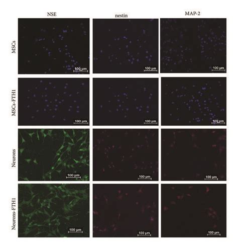 Expression Of Neuron Specific Markers Before And After Differentiation Download Scientific