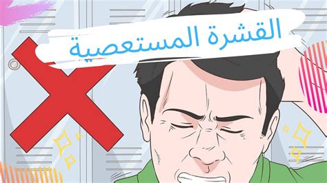 طرق علاج الالتهاب الجلدي لفروة الرأس القشرة المستعصية Youtube