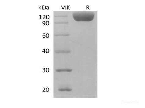 Quality Reliable Recombinant Human Siglec 10 C Fc Pksh033913 At