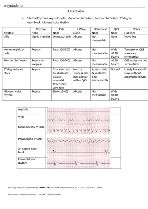 Ekg Review 6 Lethal Rhythms Asystole V Fib Monomorphic V Tach Polymorphic V Tach 3rd Degree