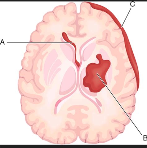 Identify The Structures Labeled A B And C In StudyX