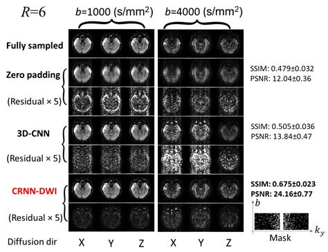 Accelerating High B Value Diffusion Weighted Mri Using A Convolutional Recurrent Neural Network