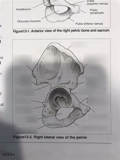 Lateral View Of The Pelvis Diagram Quizlet