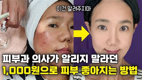 오늘당장 피부좋아지는법이것만 알면 피부과 안가도 됩니다 Youtube