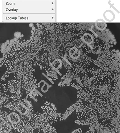 A Image Type Tool Of ImageJ And B Original Image Transformed Download Scientific