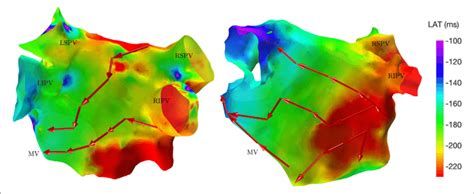 Electrical Propagation Pattern Detected By Directed Network Mapping