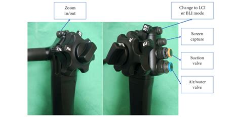 Fujifilm 700 Series Endoscope Lci Linked Color Imaging Bli Blue Download Scientific Diagram
