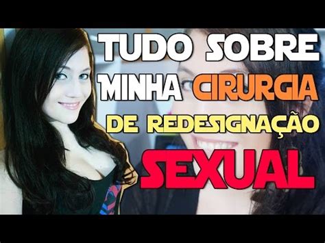 Tudo Sobre Minha Cirurgia De Redesigna O Sexual Mudan A De Sexo Youtube