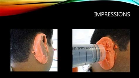 Extra Oral Defects Pptx