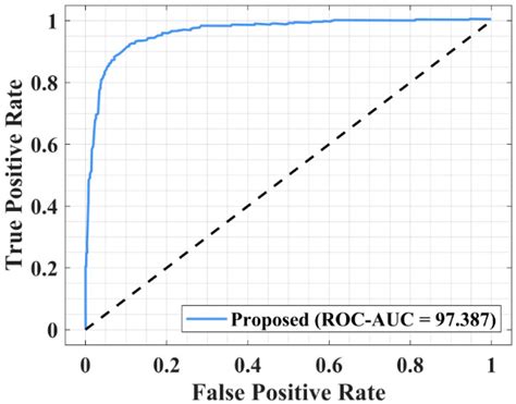 Residual Dense Optimization Based Multi Attention Transformer To Detect