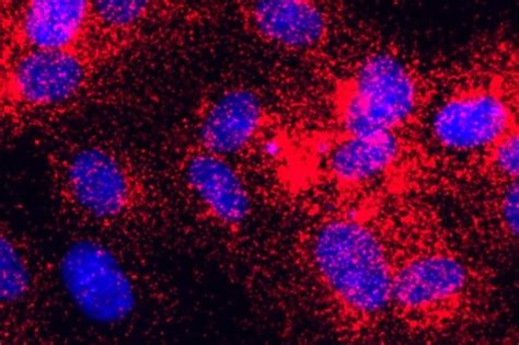 Innovative Proximity Ligation Assay Based Solutions Itk
