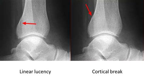 Examine Individual Bones