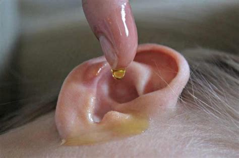 როგორ მოვიშოროთ ყურის ტკივილი 1 წუთში წვეთი რომელიც ნამდვილად შველის რჩევები ვივიენისგან